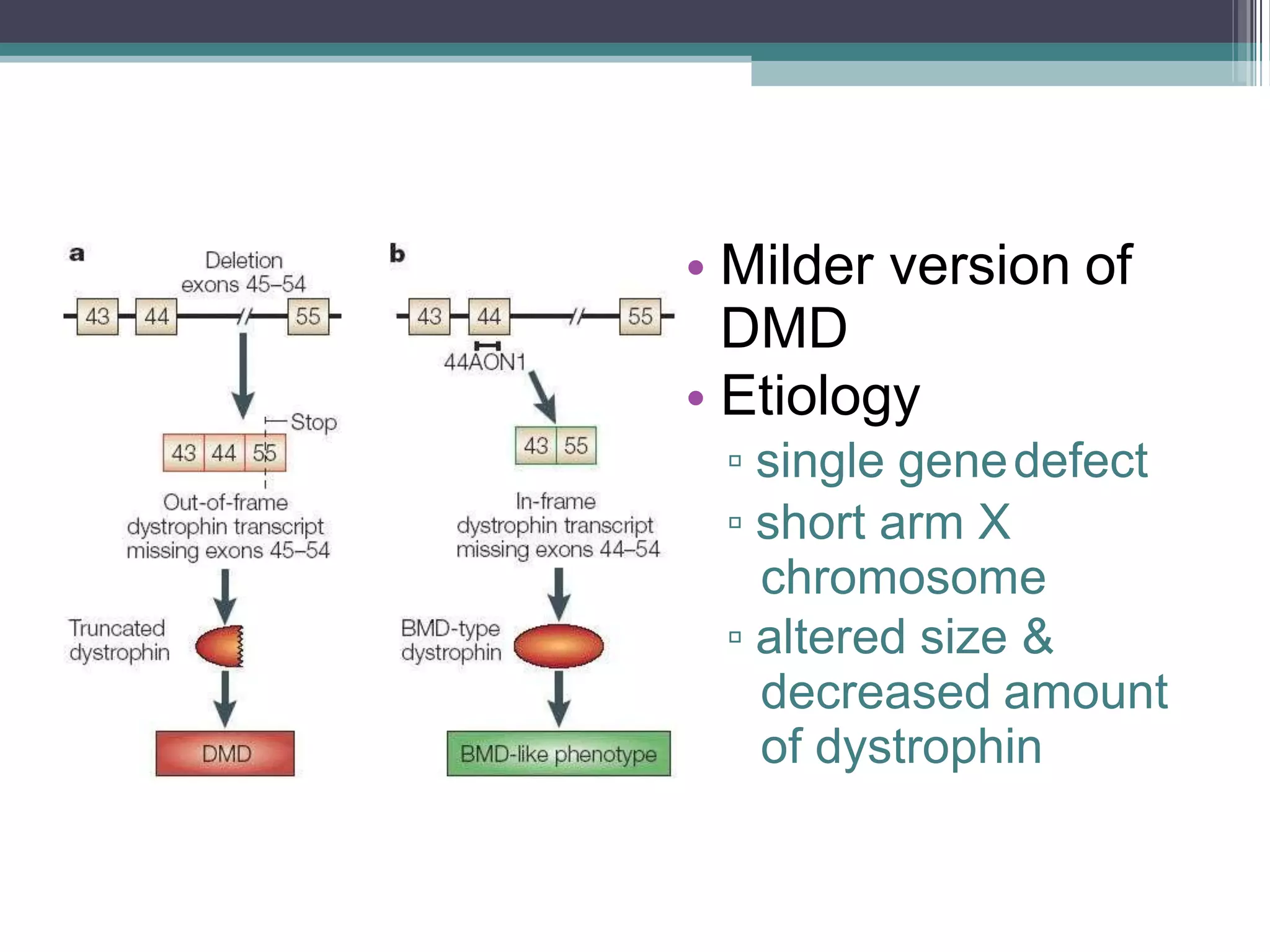 muscular dystrophy.pptx