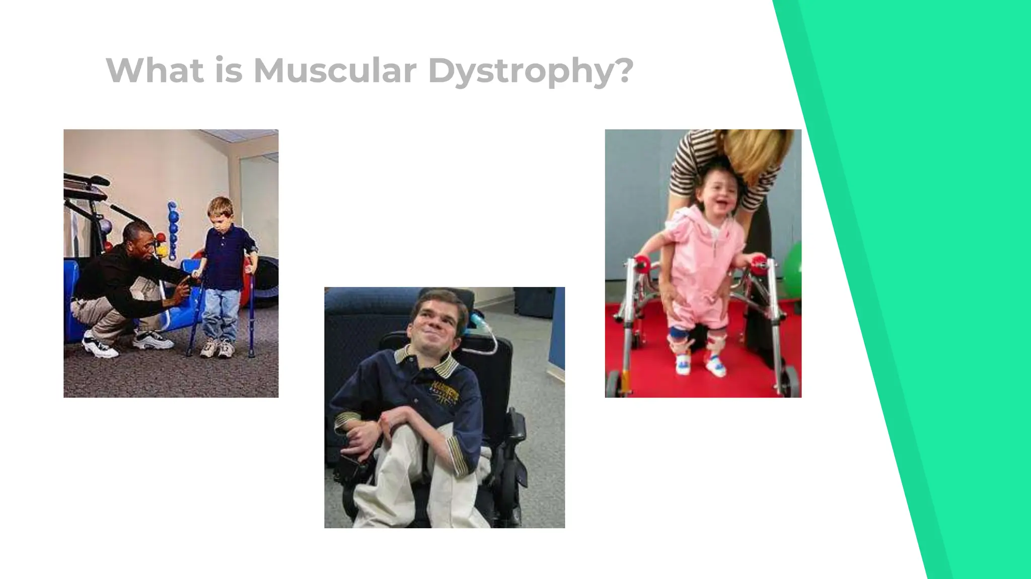 Muscular Dystrophy - A brief overview of the disease | PPTX