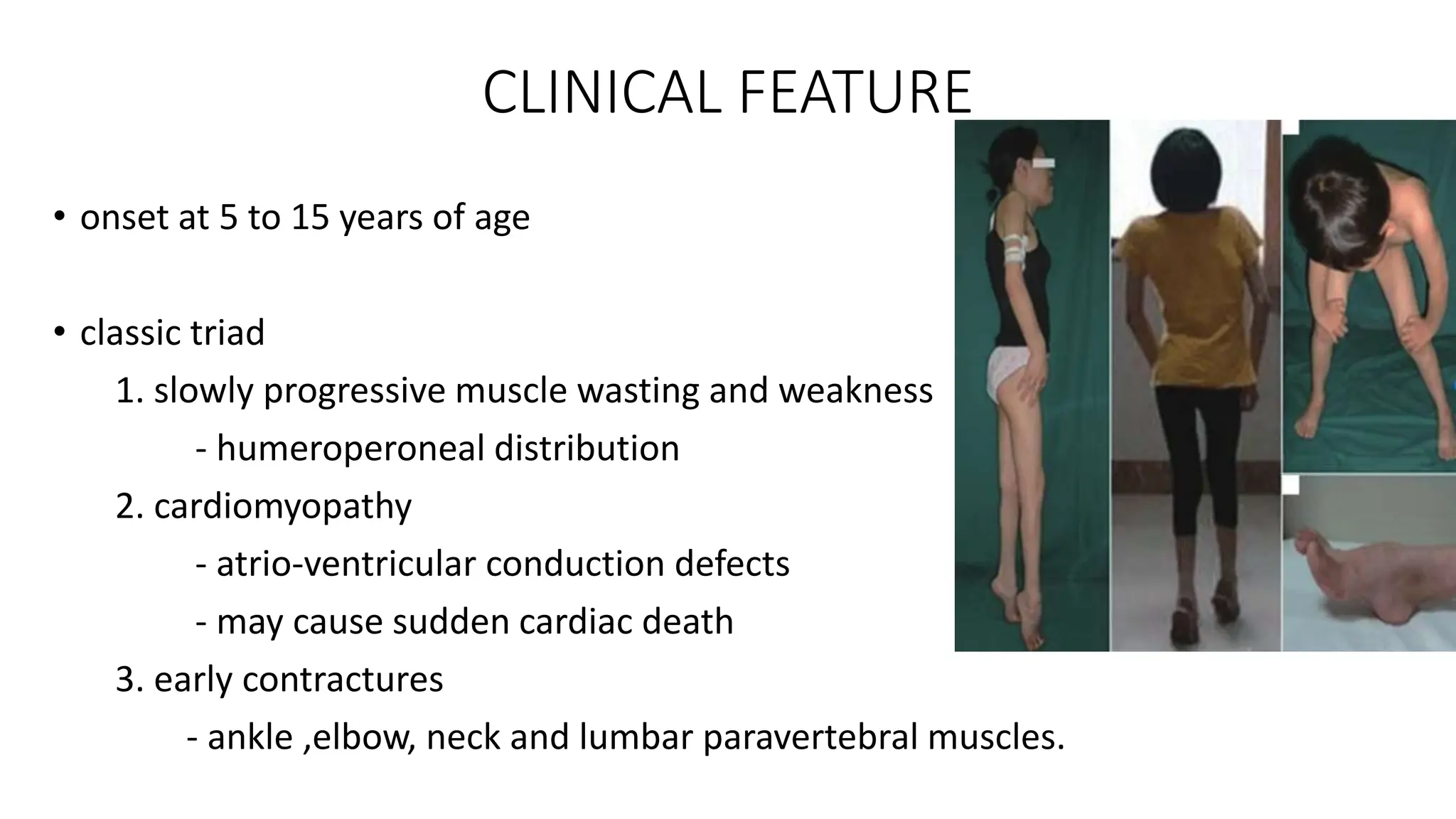 Muscle disorder and muscular dystrophy.pptx