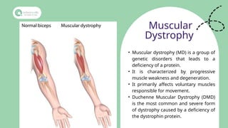 Muscular Dystrophy: Symptoms, Causes, and Stem Cell Treatment | PPTX