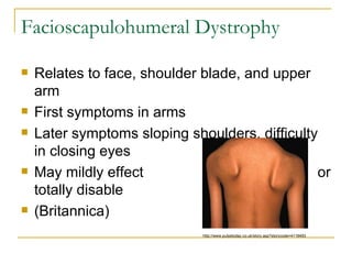 Muscular dystrophy hi | PPT