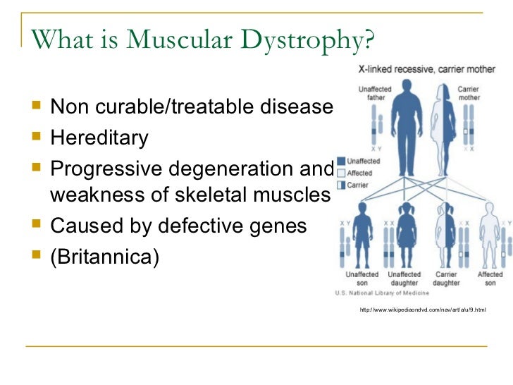 Muscular Dystrophy Graphics