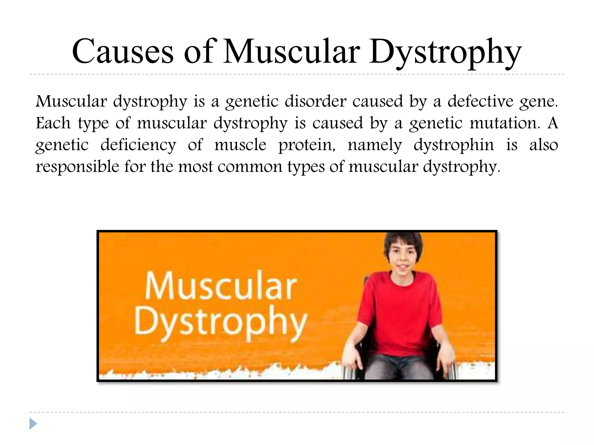 Muscular dystrophy: Group of more than 30 inherited diseases. | PPT
