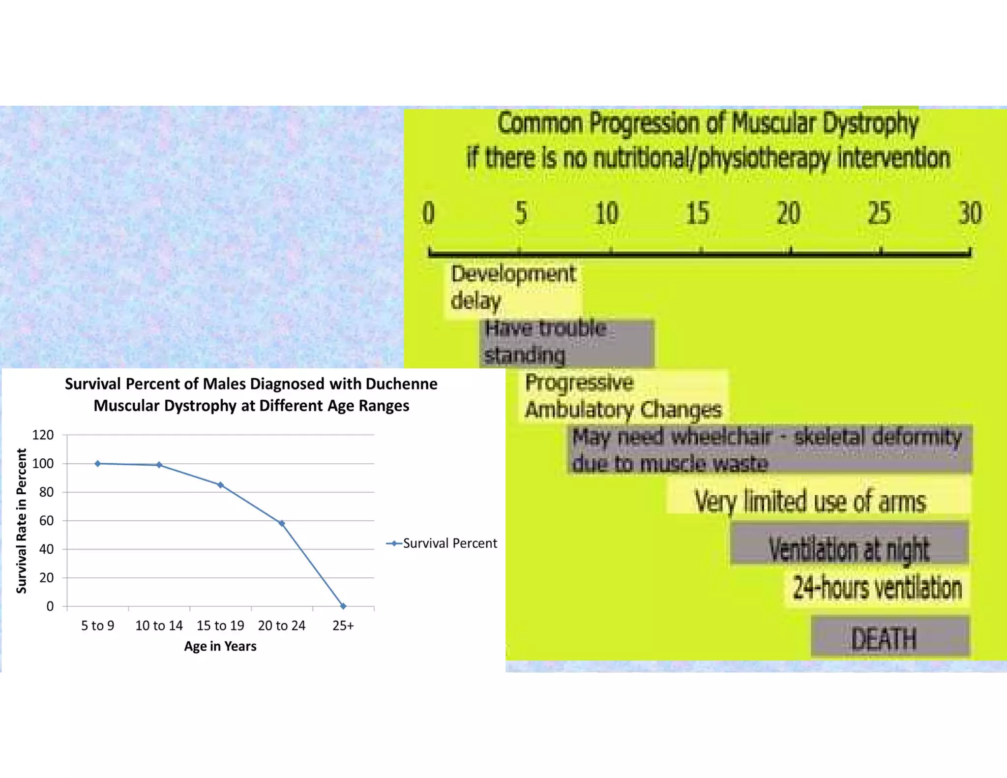MUSCULAR DYSTROPHY PPT pdf | PDF