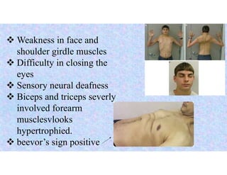 MUSCULAR DYSTROPHY PPT pdf | PDF