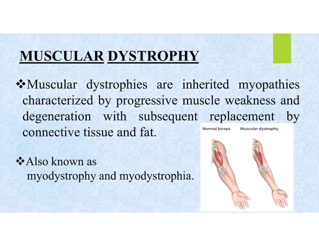 MUSCULAR DYSTROPHY PPT pdf | PDF