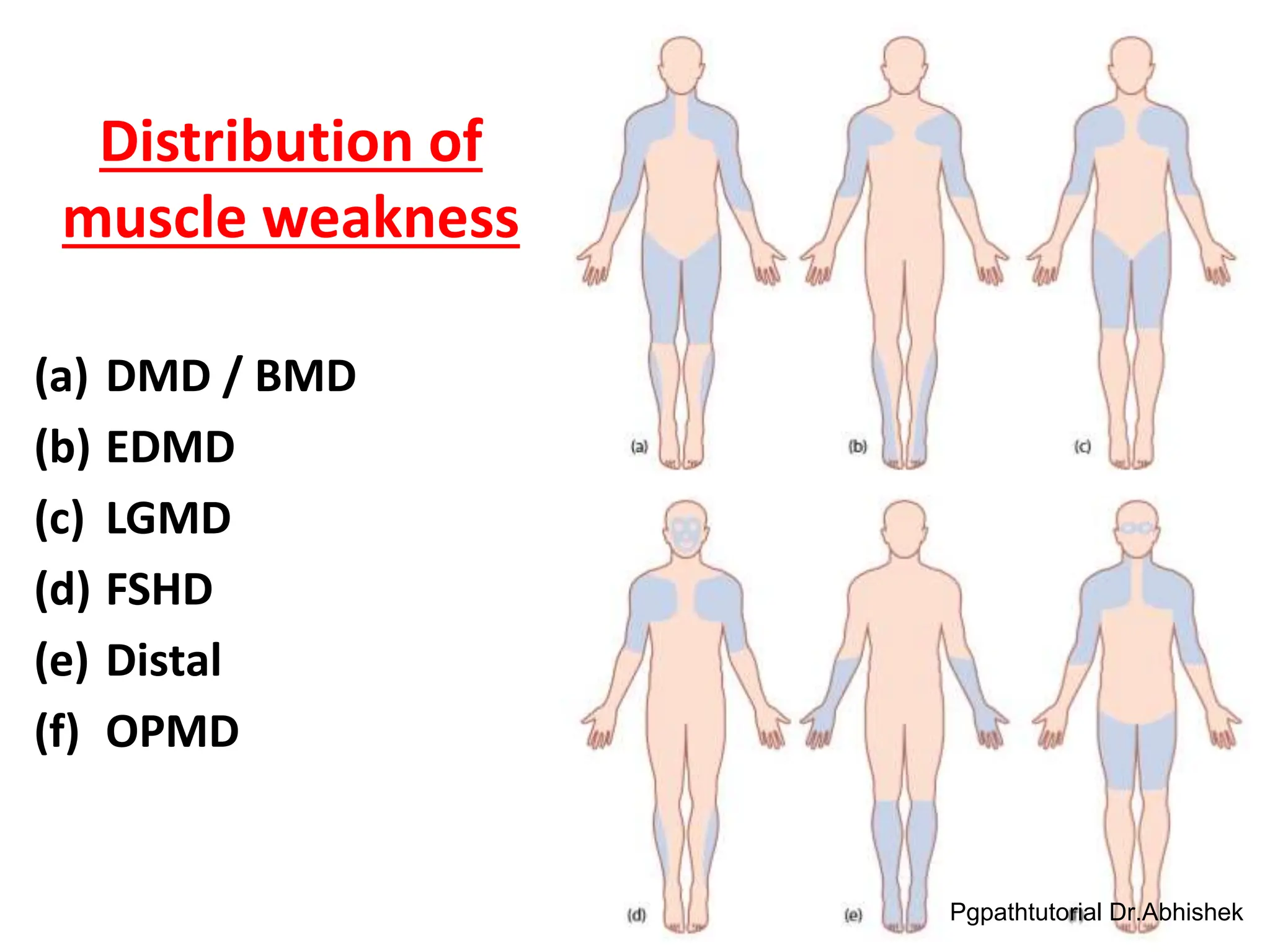 Muscular dystrophy (wecompress.com)_watermark.pdf