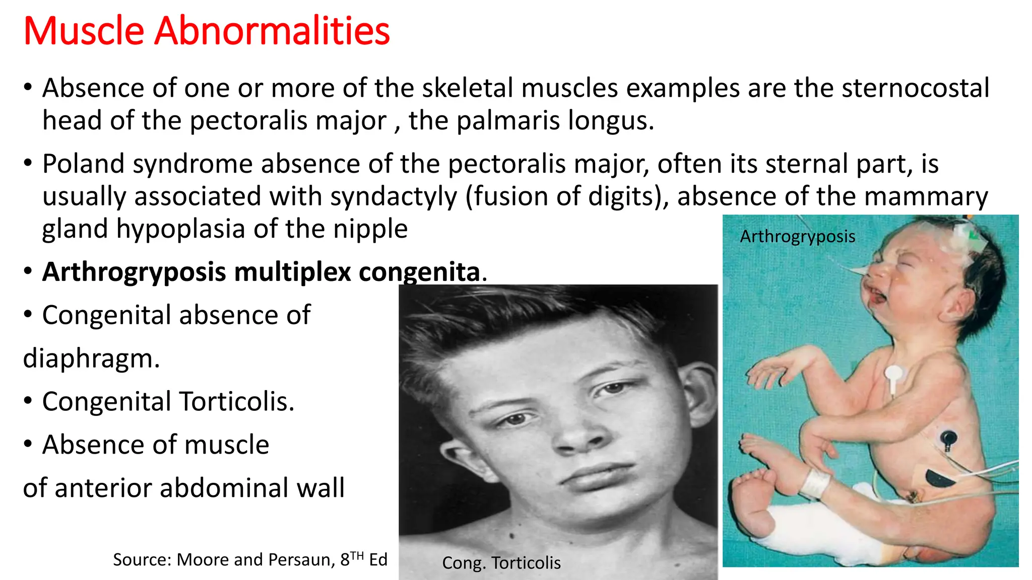 Muscular system embryology for medical students | PPTX