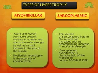 Muscular hypertrophy | PPTX