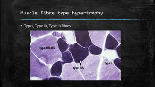 Muscular hypertrophy presentation | PPTX