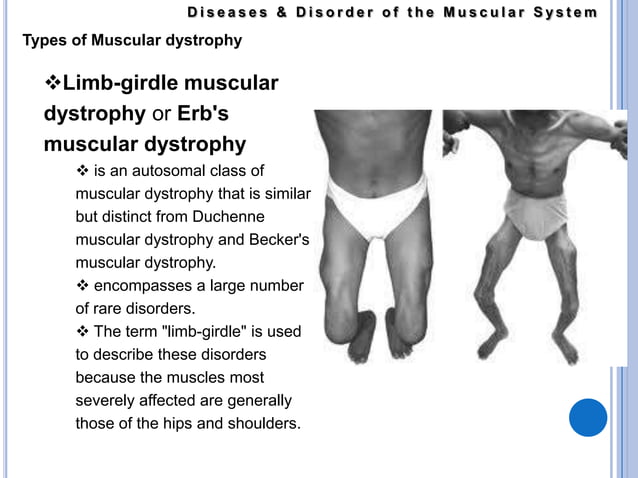 Muscular system | PPSX