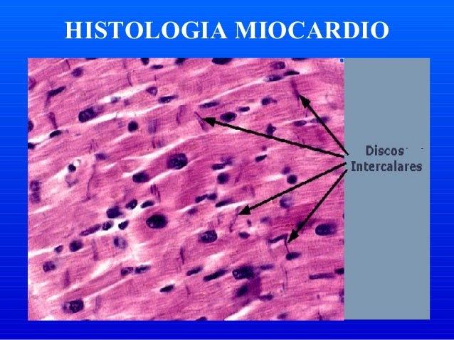 Musculo cardiaco-20091