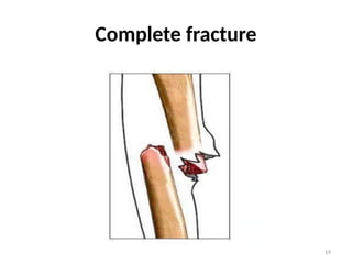 Musculo-skeletal disorders fracture and dislo.pptx