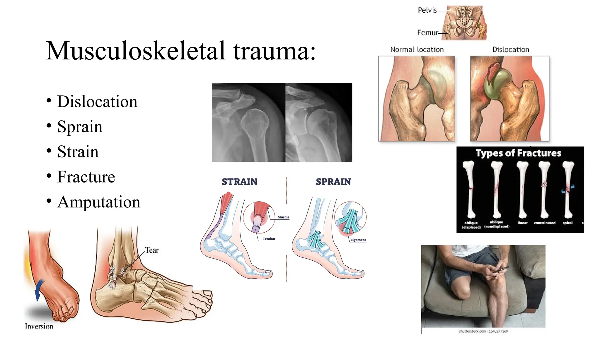 MUSCULO-SKELETAL SYSTEM: Adult Health Nsg.pptx