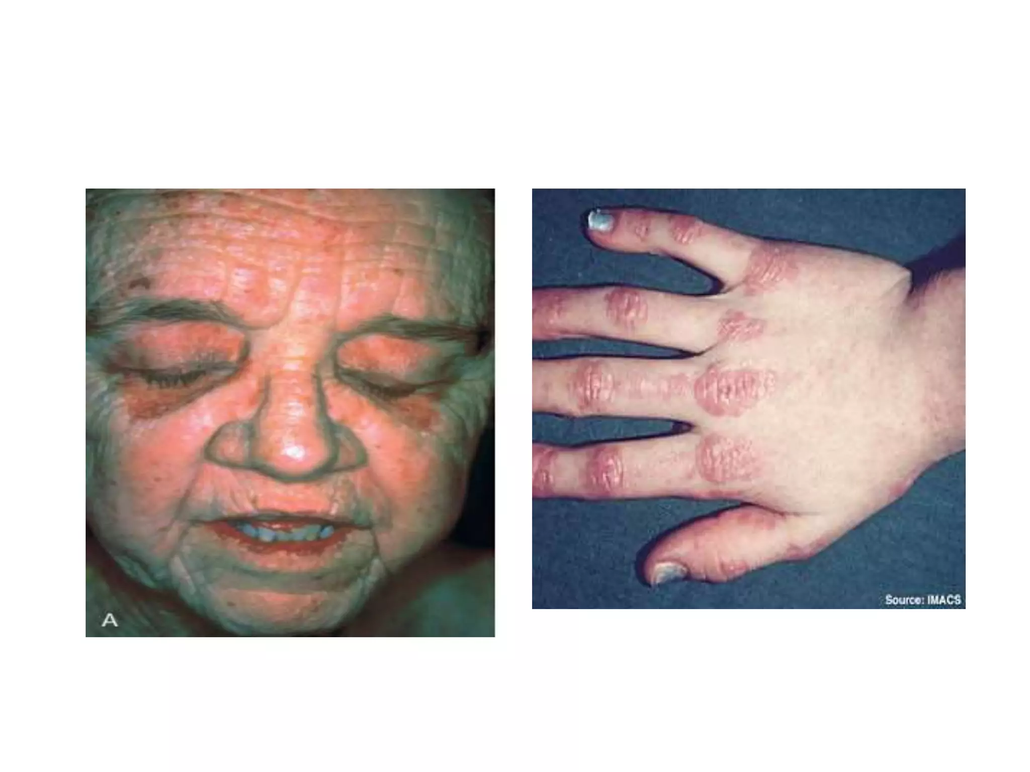 musculoskeletal.pptx