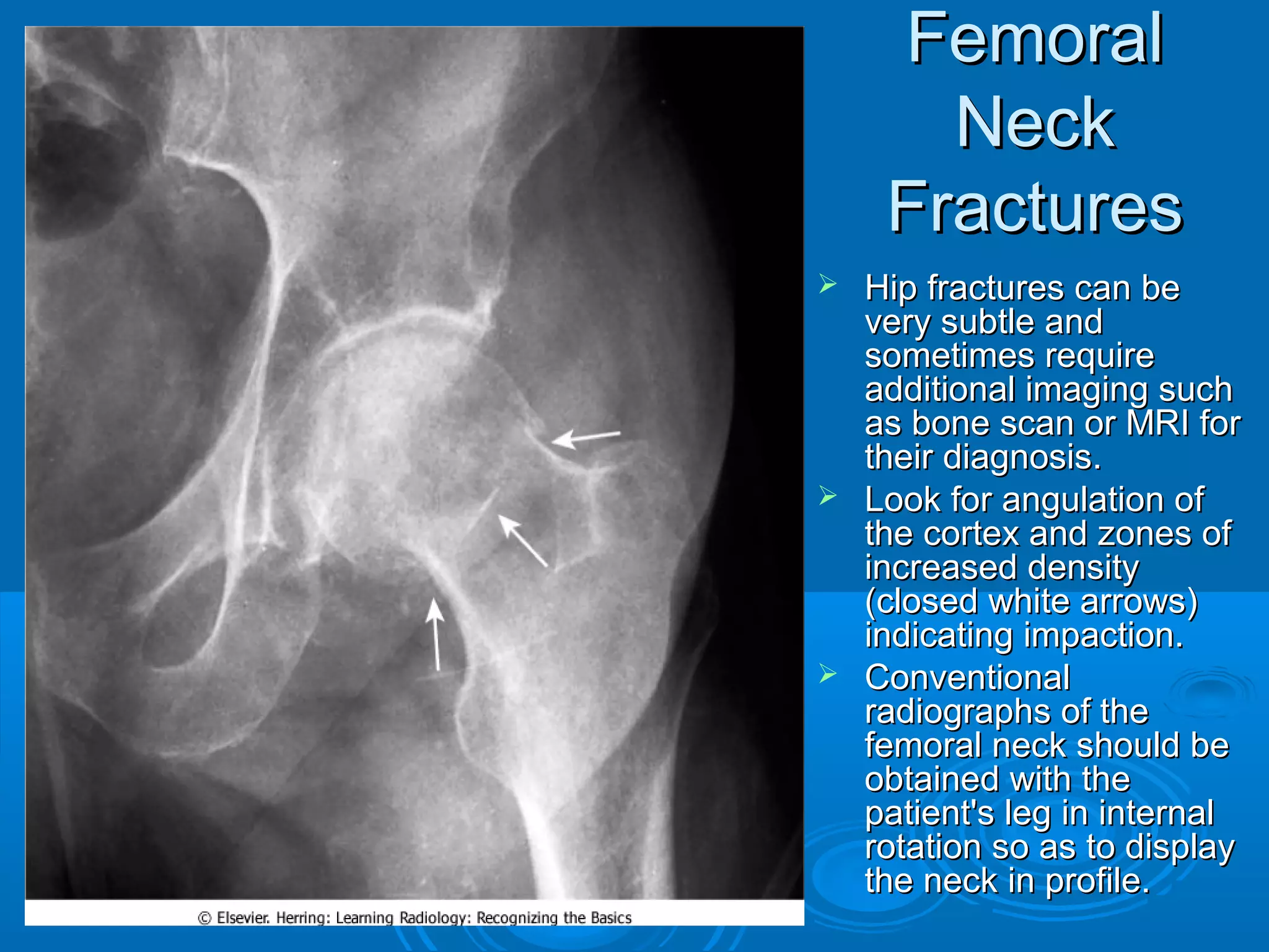 Musculoskeletal Radiology | PPT