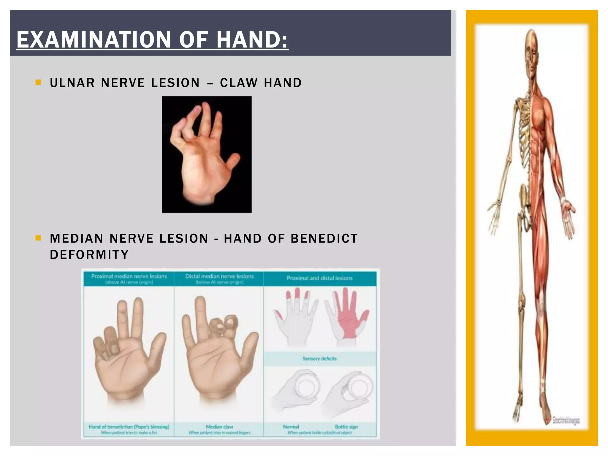 MUSCULOSKELETAL%20SYSTEM.pptx | Death, Injury, or Military Conflict | Sensitive Topics