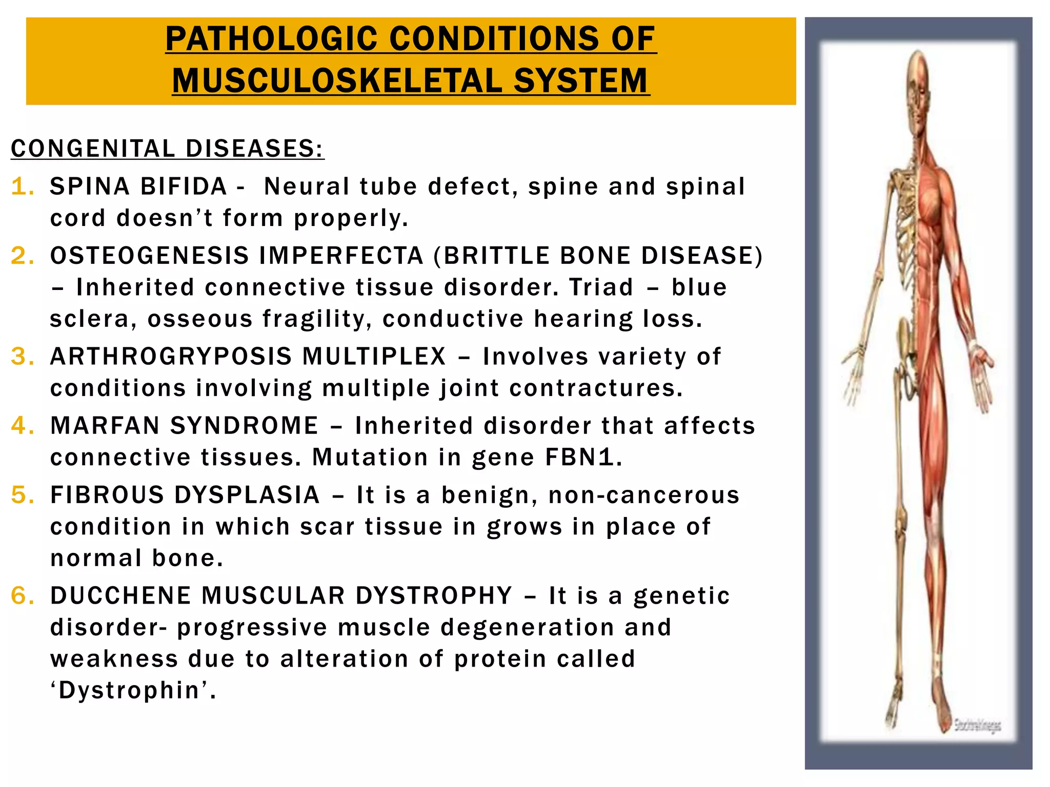 MUSCULOSKELETAL%20SYSTEM.pptx | Death, Injury, or Military Conflict ...