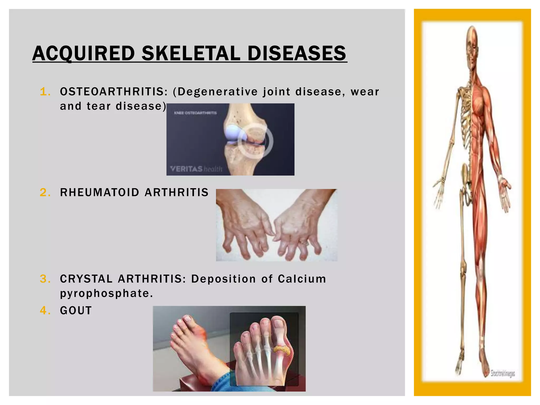 MUSCULOSKELETAL%20SYSTEM.pptx | Death, Injury, or Military Conflict | Sensitive Topics
