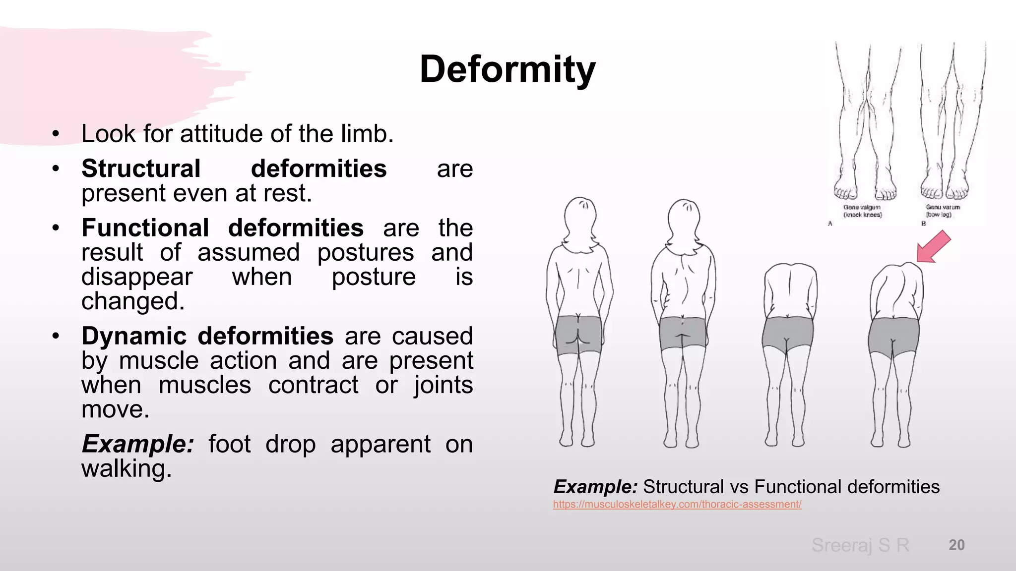 Musculoskeletal Assessment (Principles and Concepts for ...