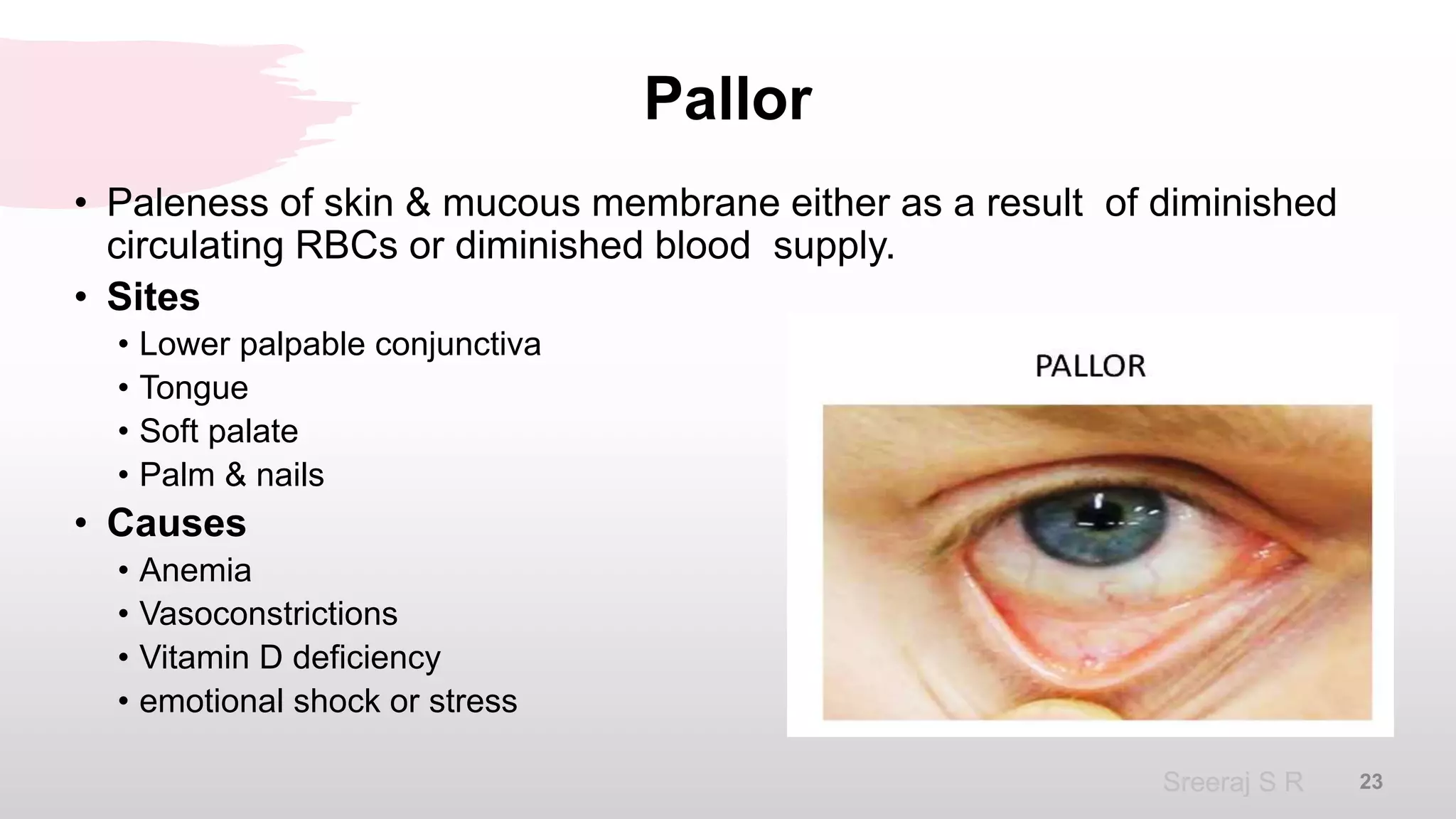 Musculoskeletal Assessment (Principles and Concepts for ...