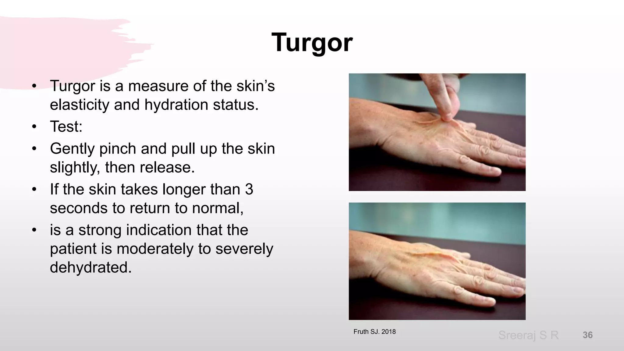 Musculoskeletal Assessment (Principles and Concepts for ...