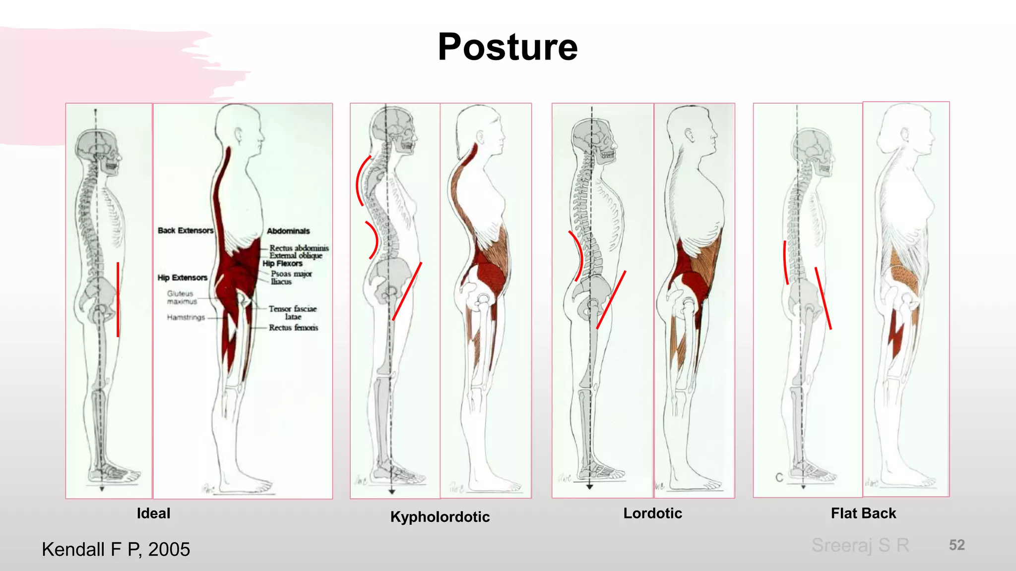 Musculoskeletal Assessment (Principles and Concepts for ...