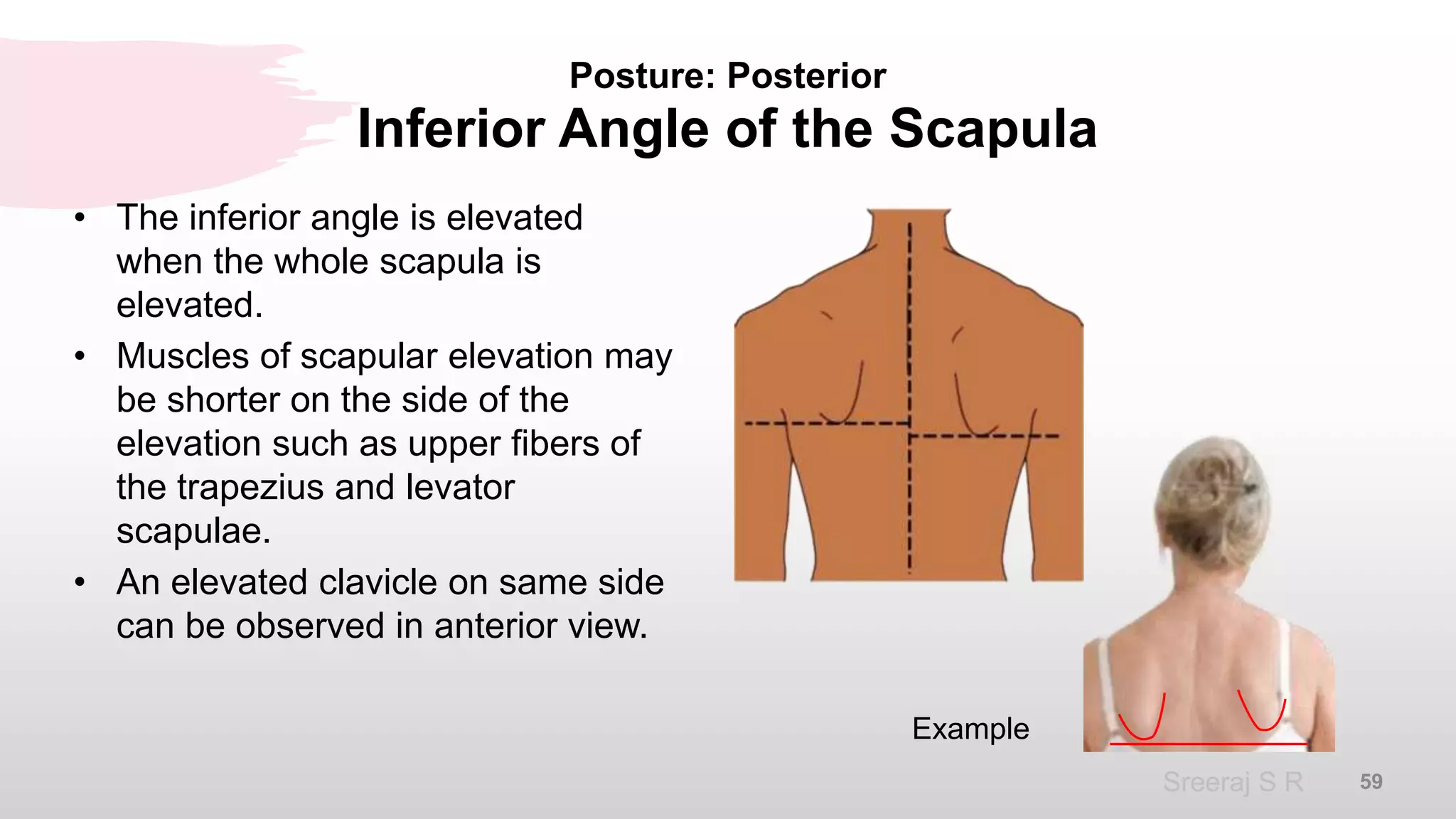 Musculoskeletal Assessment (Principles and Concepts for ...