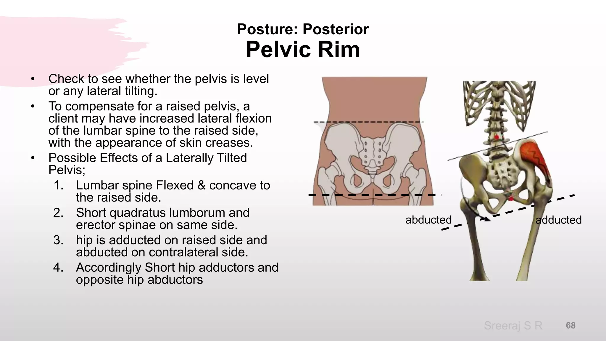 Musculoskeletal Assessment (Principles and Concepts for ...