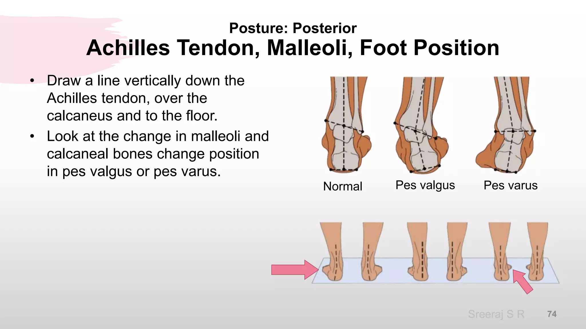 Musculoskeletal Assessment (Principles and Concepts for ...