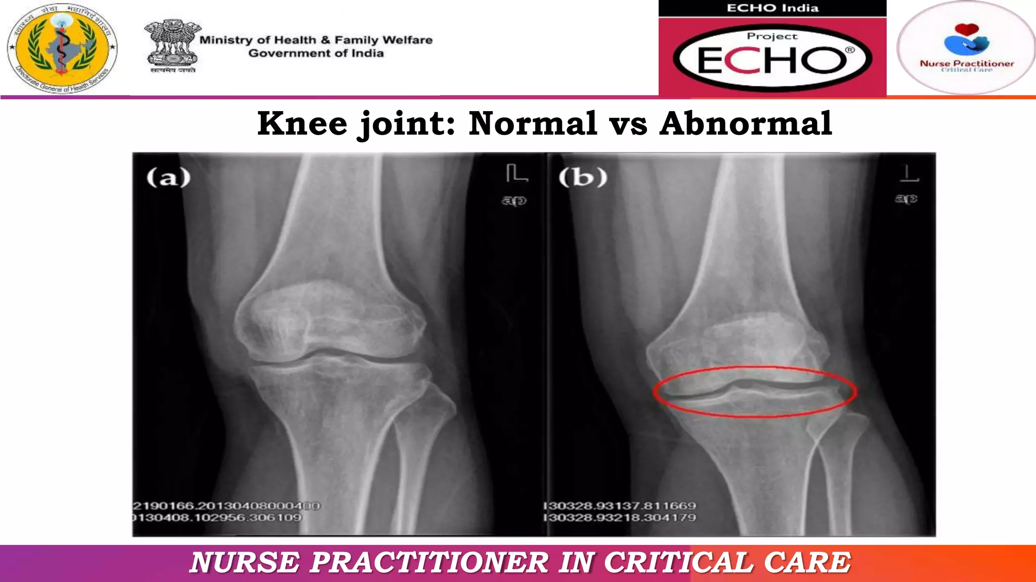 Musculoskeletal assessment ppt.pptx