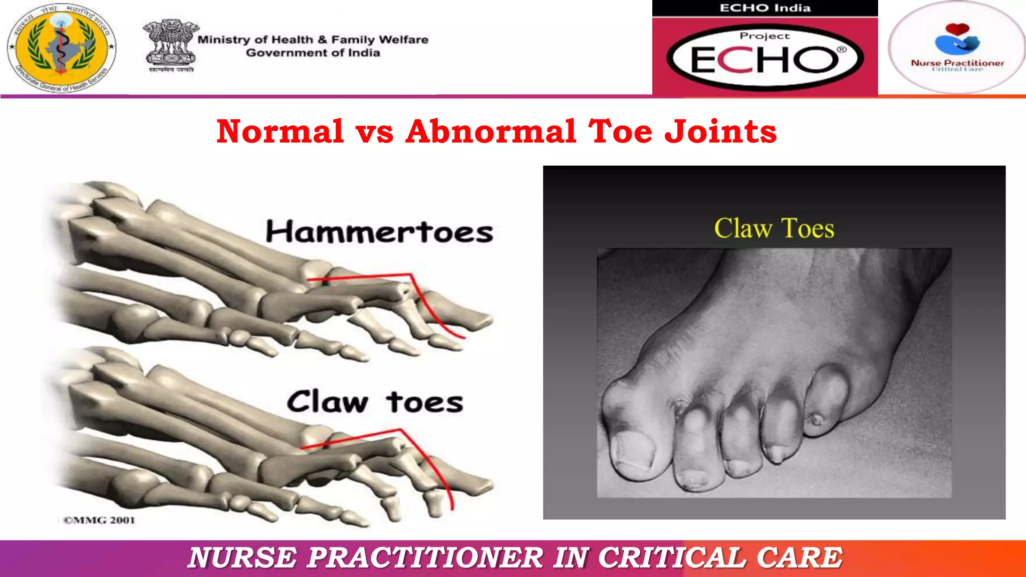 Musculoskeletal assessment ppt.pptx