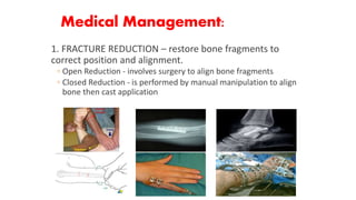 Musculoskeletal conditions, fractures | PPTX