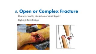 Musculoskeletal conditions, fractures | PPT