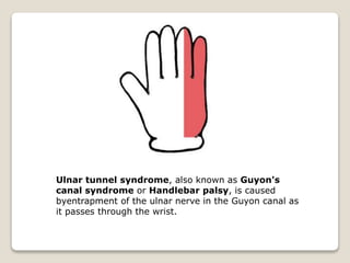Musculoskeletal disorders | PPTX