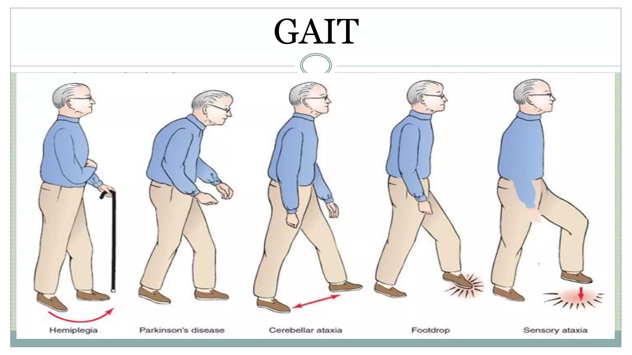 Musculoskeletal disorders | PPTX