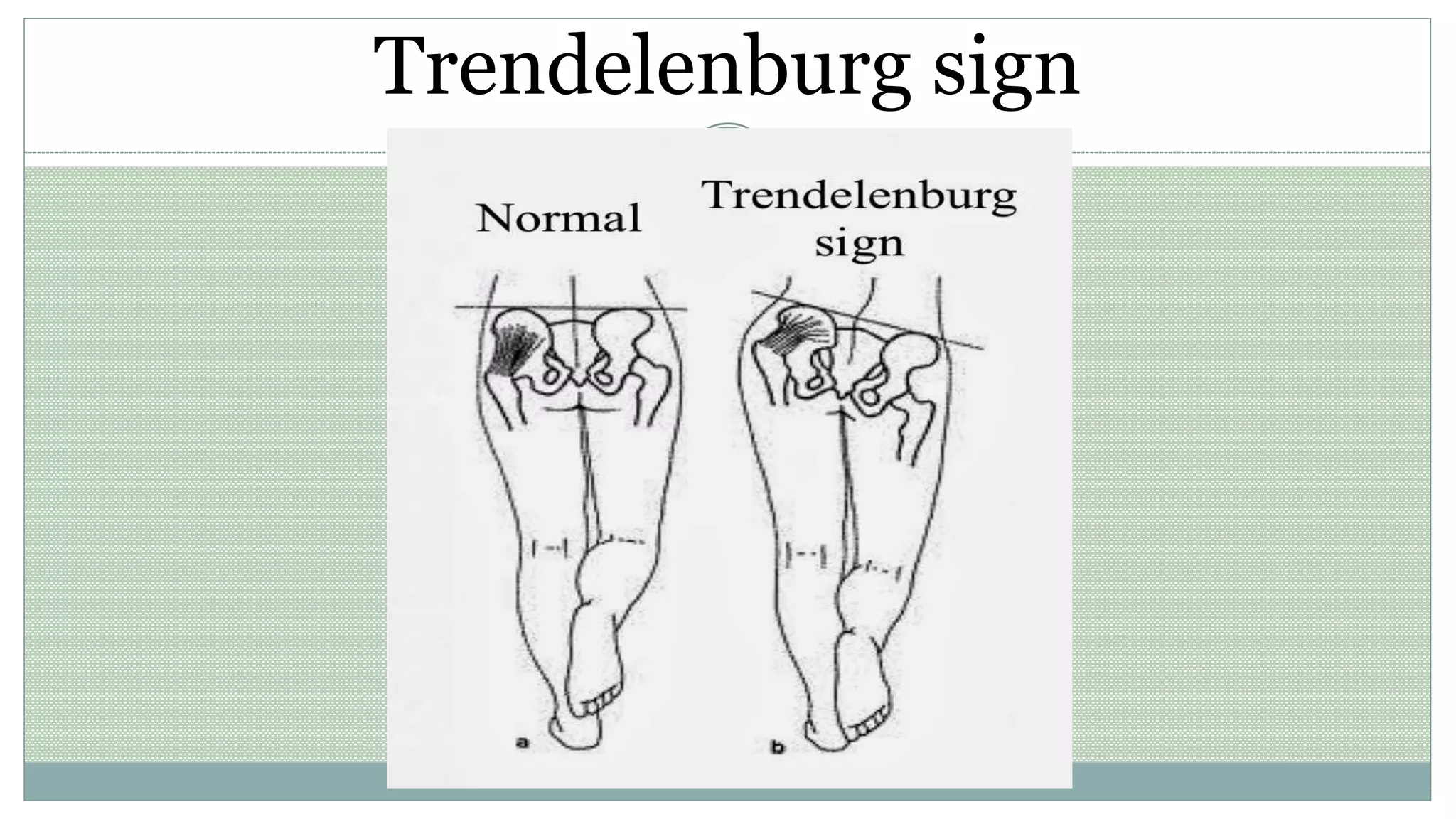 Musculoskeletal disorders | PPTX