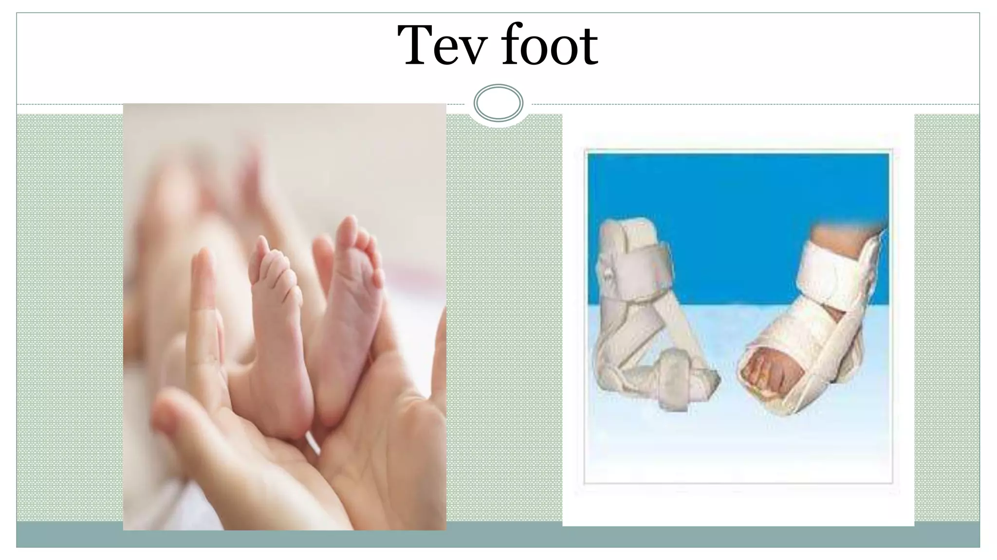 Musculoskeletal disorders | PPTX
