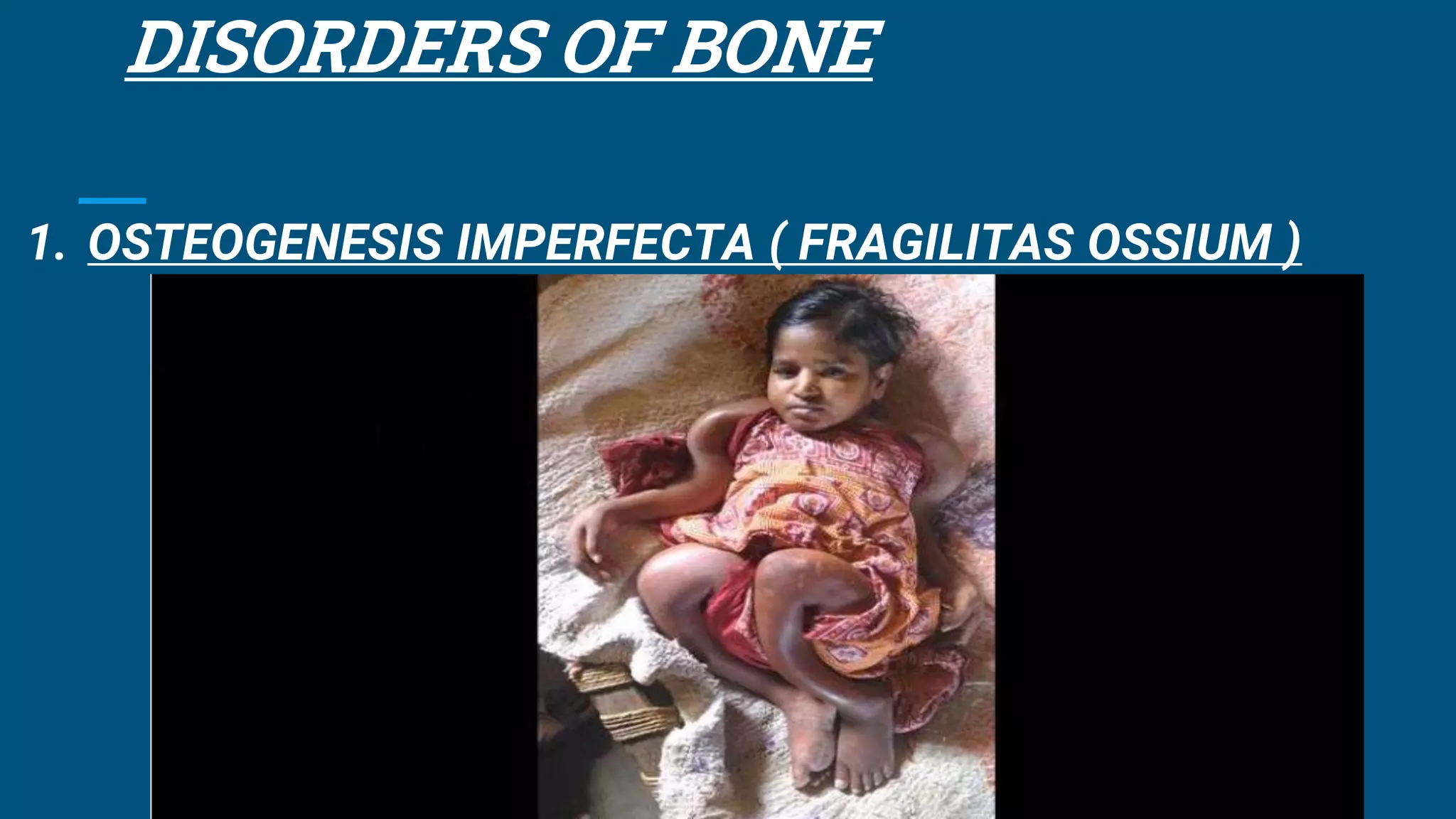 _Musculoskeletal Disorders - CHN.pptx