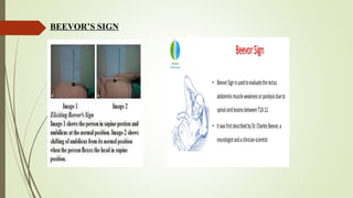 MUSCULO SKELETAL DISORDERS PART-II PPT . | PPT