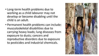 Musculoskeletal disorders in child labour.pptx | Physical Therapy ...