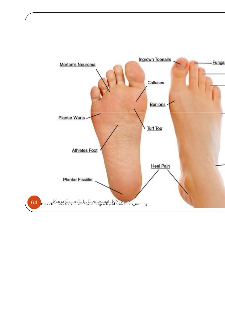 Musculoskeletal disorders part 1 cld