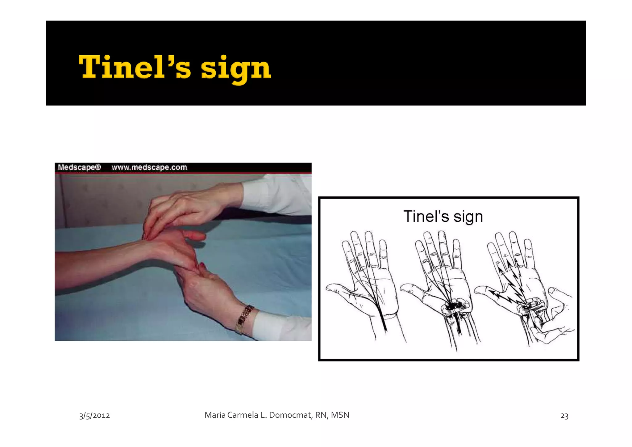 Musculoskeletal disorders Part 4 Disorders of the Hands: Carpal Tunnel ...