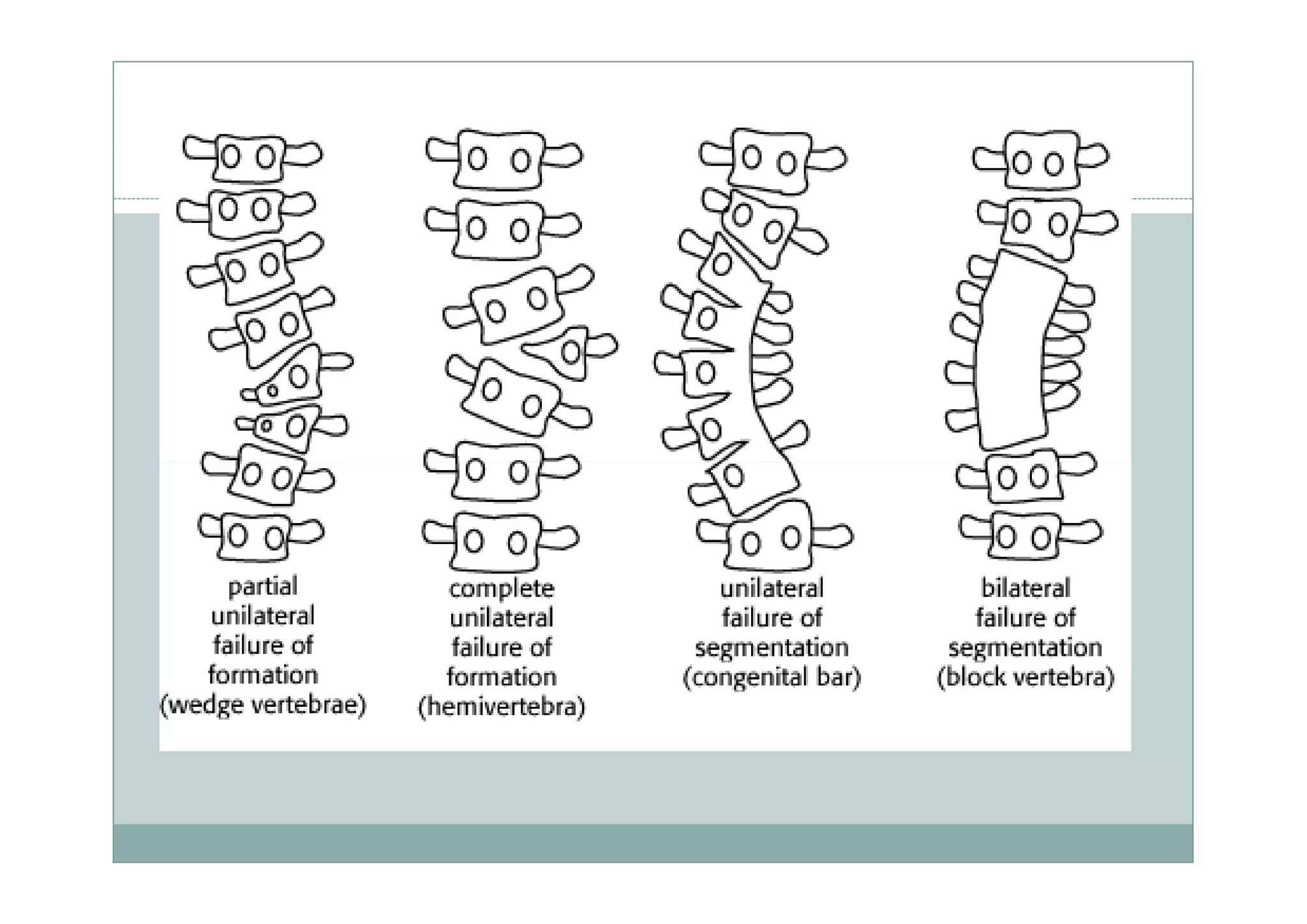 Spinal Column Deformities | PDF