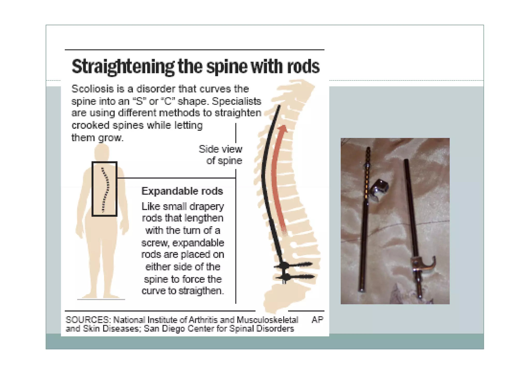Spinal Column Deformities | PDF
