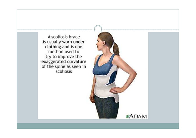 Spinal Column Deformities | PDF