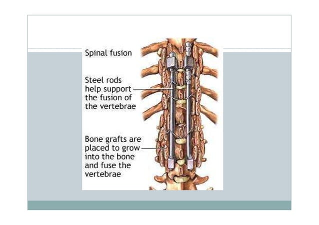 Spinal Column Deformities | PDF