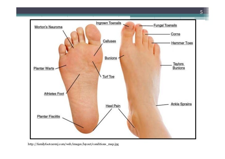 Musculoskeletal Disorders of the feet