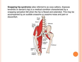 Musculoskeletal disorders | PPTX