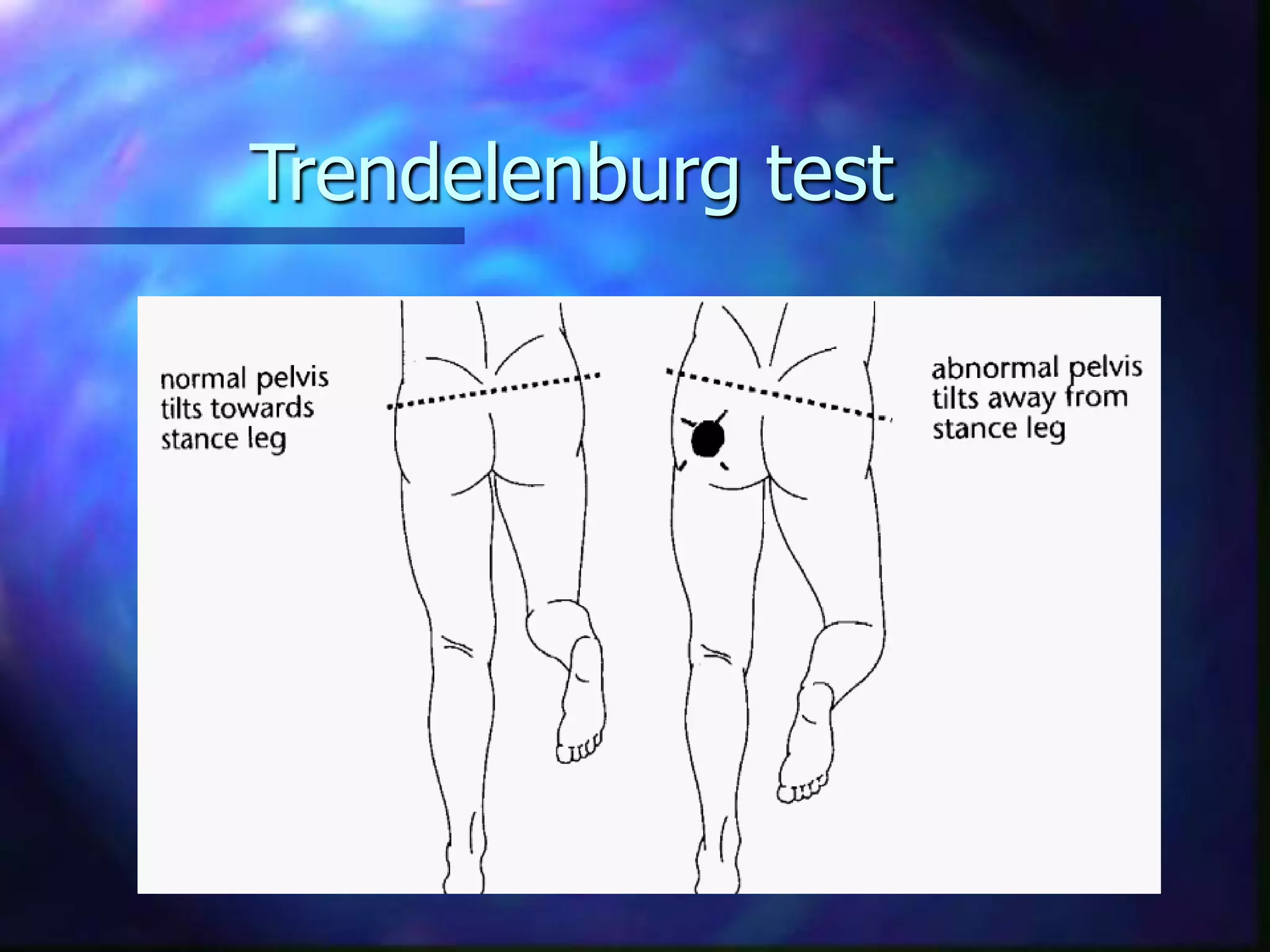 Musculoskeletal Examination.ppt